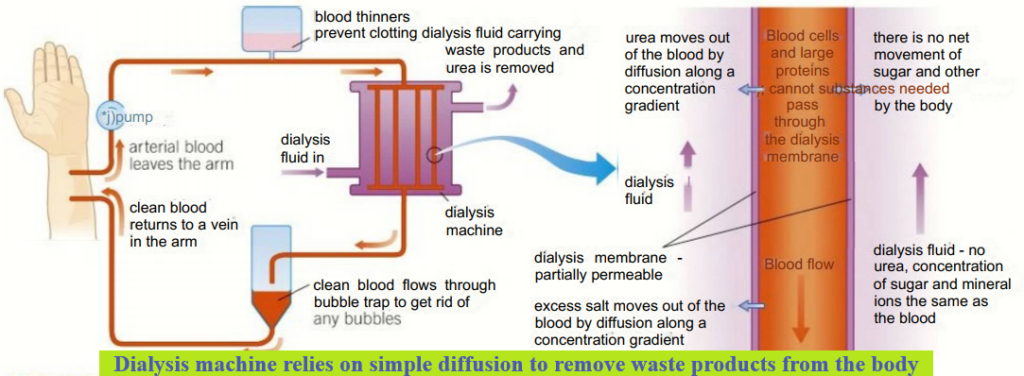 How to Detect Kidney Failure, Causes, And Effects - Elightenknowledge.com